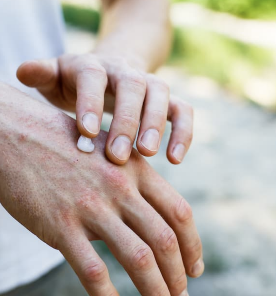 Guide to Topical THC Creams and Lotions - FLUENT